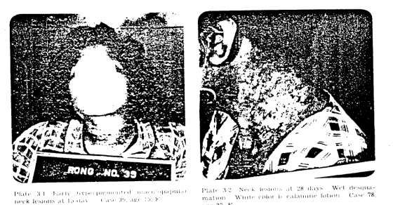 10 Of The Most Evil Human Experiments Ever | ThatViralFeed