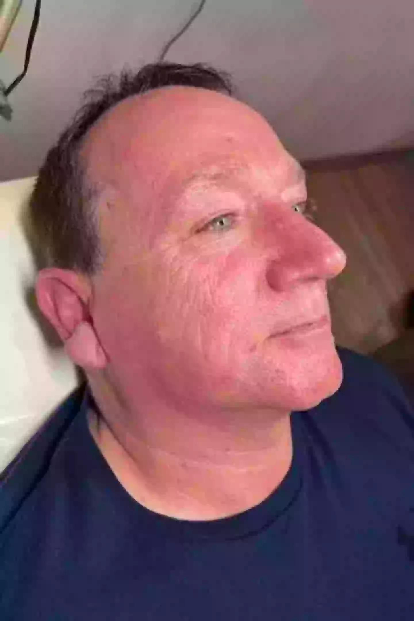 Truck Driver Who Never Used Sunscreen Reveals Dramatic Difference On ...